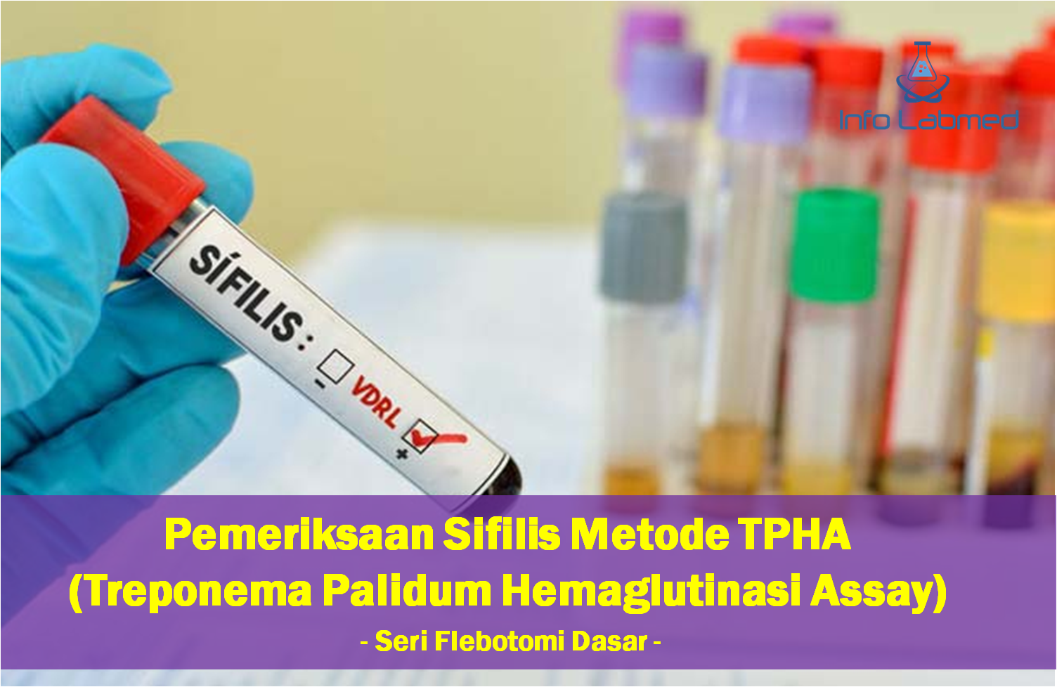 Pemeriksaan Sifilis Metode TPHA (Treponema Palidum Hemaglutinasi Assay ...
