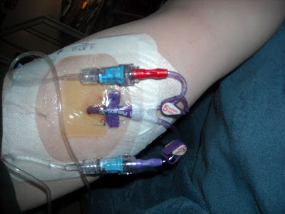 My Story of Hyperemesis: Picc Line Pic