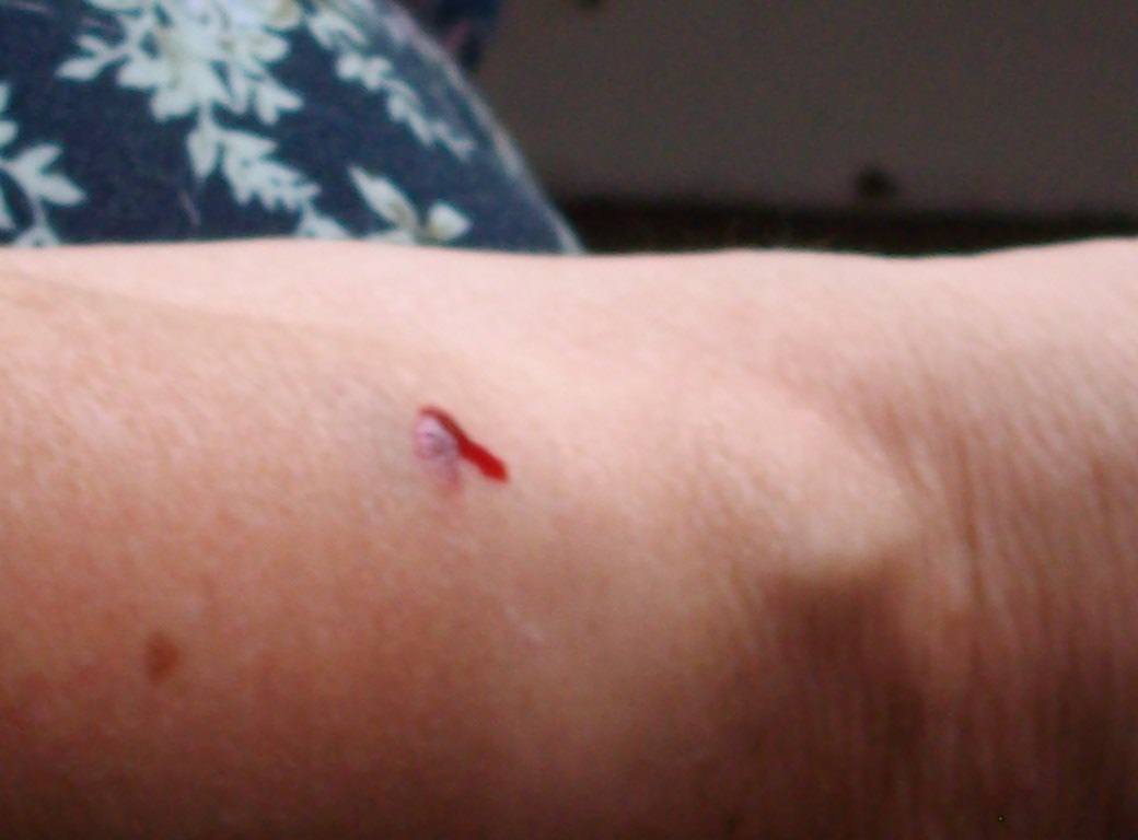 Follyfarm: Psycho Hen.