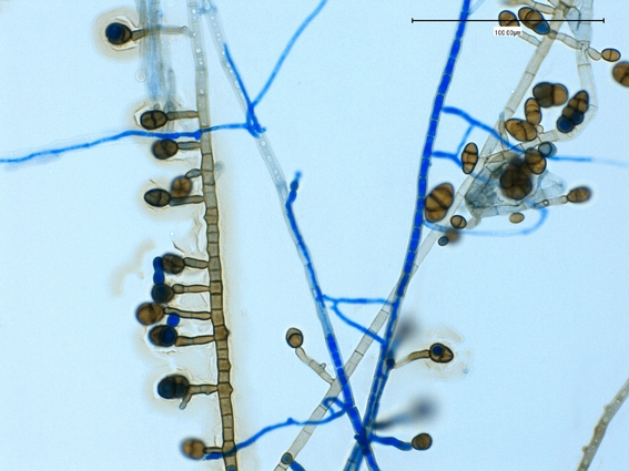 Fun With Microbiology (What's Buggin' You?): Stemphylium species