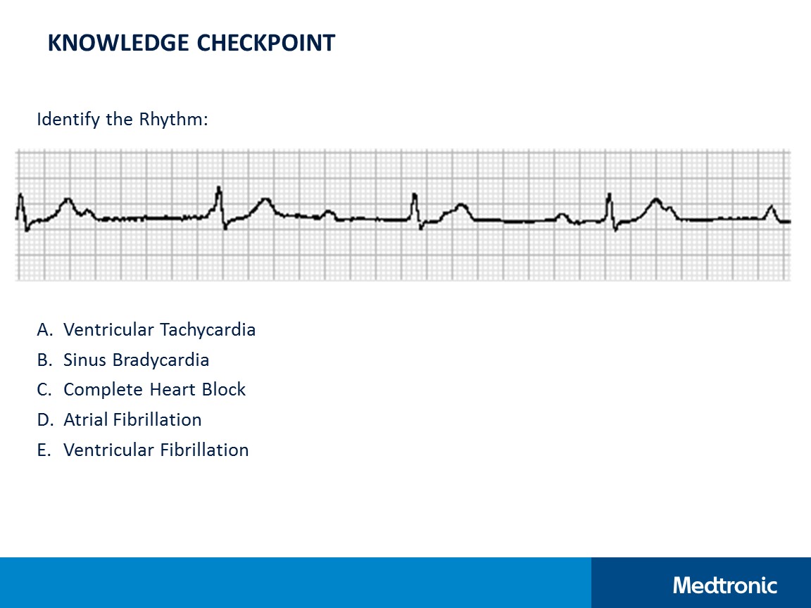 CVT Mohd Farid: Heart Rhythm Interpretation Part I-Medtronic Academy