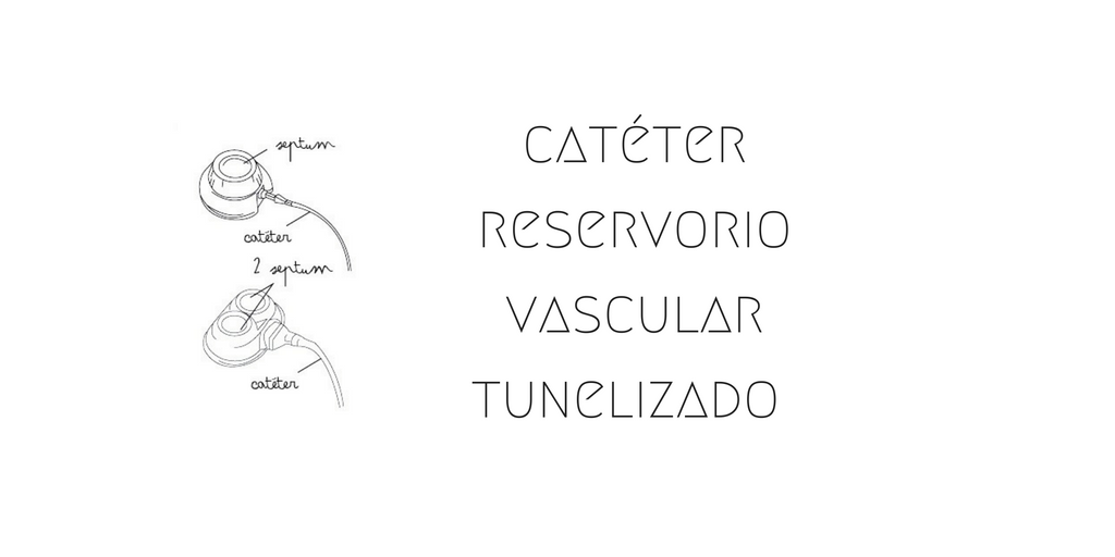 RESERVORIO SUBCUTANEO - El arte de cuidarte