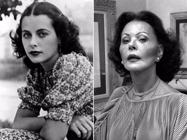 11 Classic Hollywood Stars Who Had Plastic Surgery ~ Vintage Everyday