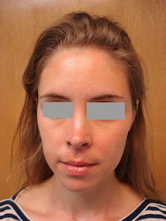 VIRTUAL GRAND ROUNDS IN DERMATOLOGY 2.0: Deadline Looming