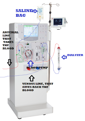 7 QUICK STEPS TO SETTING UP A K, K2 FRESENIUS MACHINE | *Dialysis ...