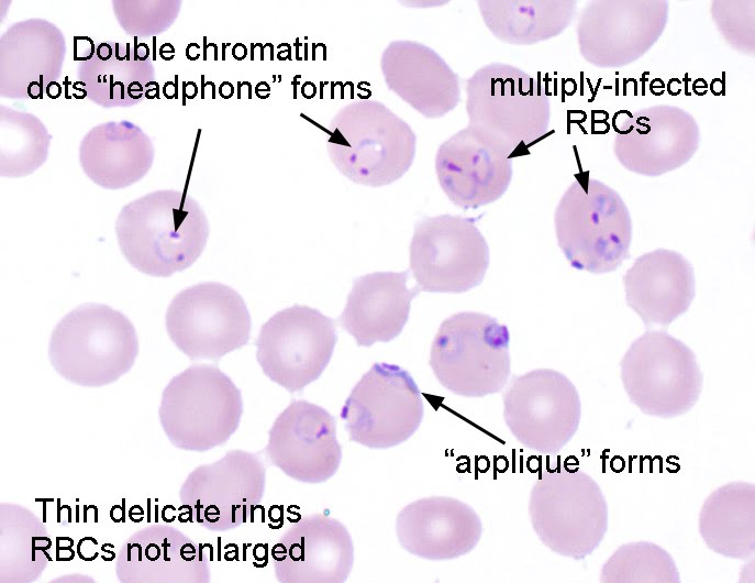 Creepy Dreadful Wonderful Parasites: Answer to Case 158