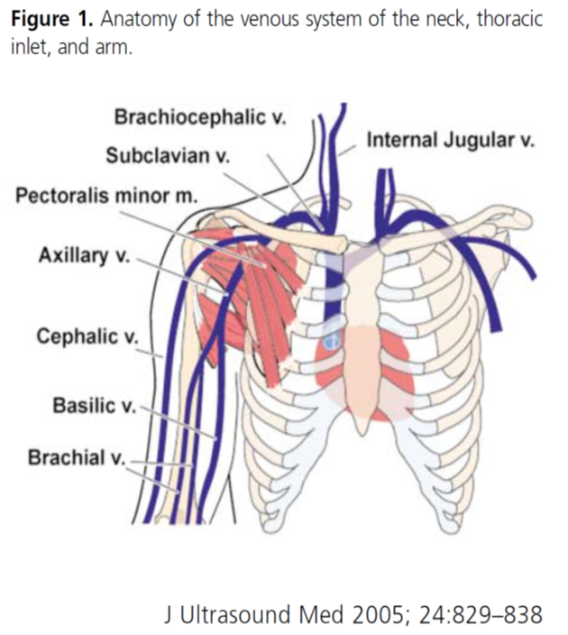 Central Venous Access
