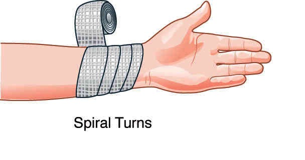 Medical : Taber's Medical Dictionary:Bandage