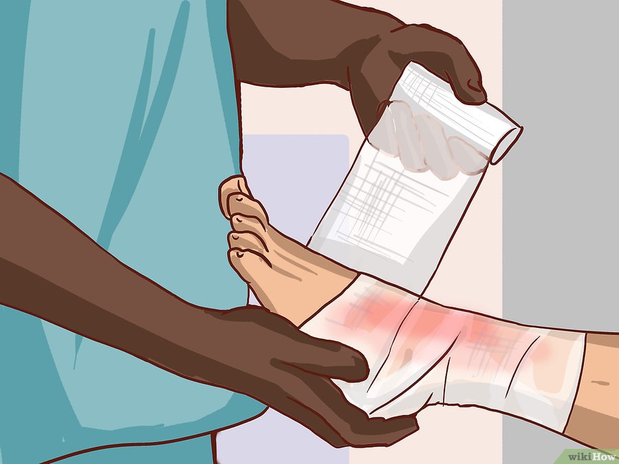 Gini Cara Menggunakan Berbagai Jenis Perban | Suara Literasi Perawat ...