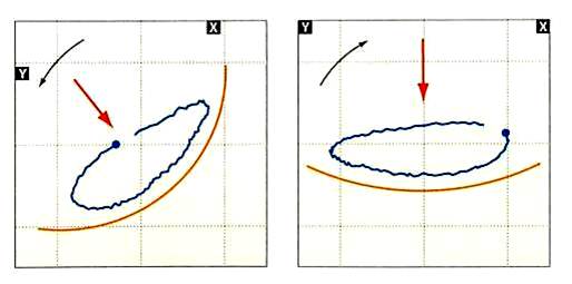 Vibration Analysis: Shaft Orbit Plots (II)