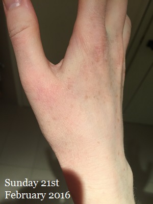 Hand-some | TSW Cara