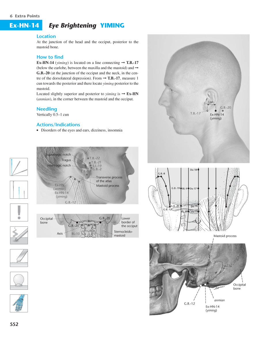 Acupuncture Masters: Acupuncture Points Database - Extra Points