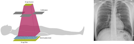 Image Processing - Image sources: X-ray Imaging