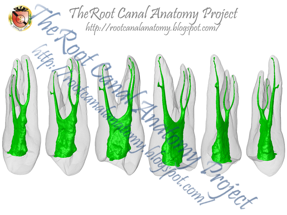 The Root Canal Anatomy Project: Three-Rooted Maxillary First Premolar