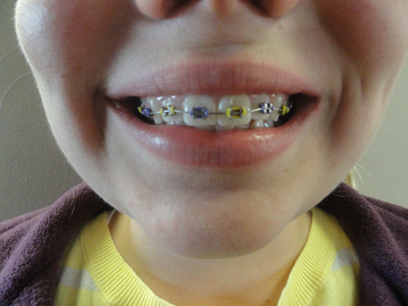 Splan/ Sullivan Spotlight: Home Updates, Homecoming, Braces!