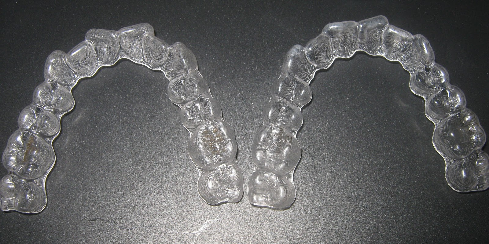Br@ndy's Invisalign Journey: Tray 10