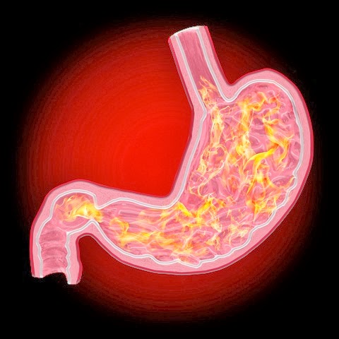 Yuppie Farm Girl: 5 Easy Ways to Improve Gut Health - What is all this ...