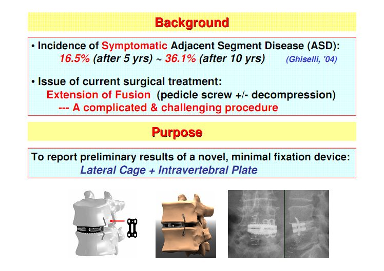 Spine Update 脊椎新事: 腰椎鄰近節病變的手術治療 (Lumbar Adjacent Segment Disease)