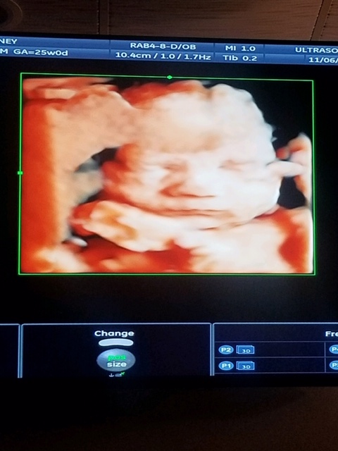 BARNETT BABY: 25 WEEK ULTRASOUND!