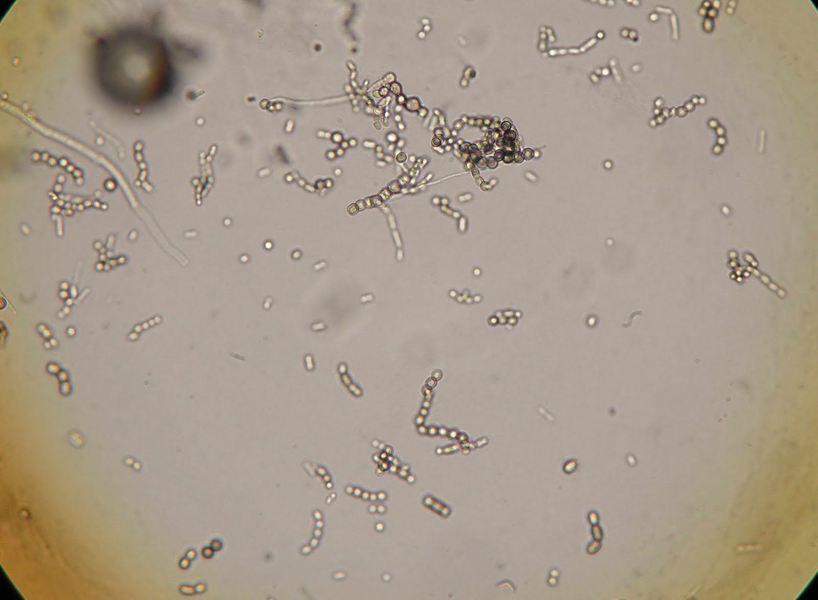 ATLAS MICOLOGIA: SCYTALIDIUM DIMIDIATUM (Neoscytalidium dimidiatum)