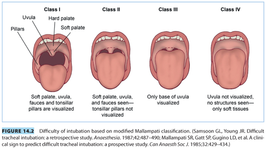 10 Things your Anaesthesiologist Asks You At Your First Meeting