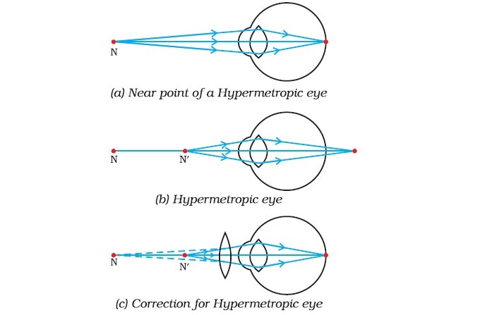 science: CLASS X :HUMAN EYE AND THE COLOURFUL WORLD