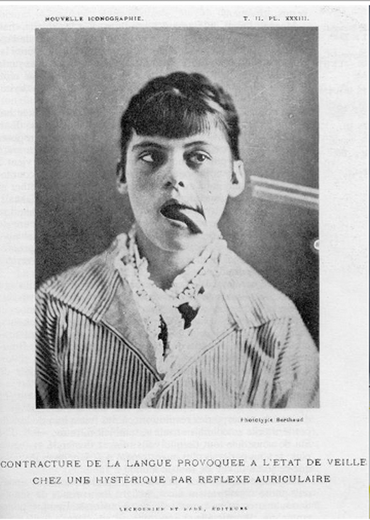 Of Sound Minds and Tuning Forks: Charcot’s Acoustic Experiments at the ...