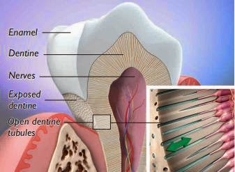 Sensitive Teeth - Star Dental Assisting School