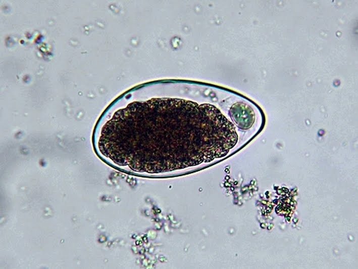 Fun With Microbiology (What's Buggin' You?): Hookworm ...