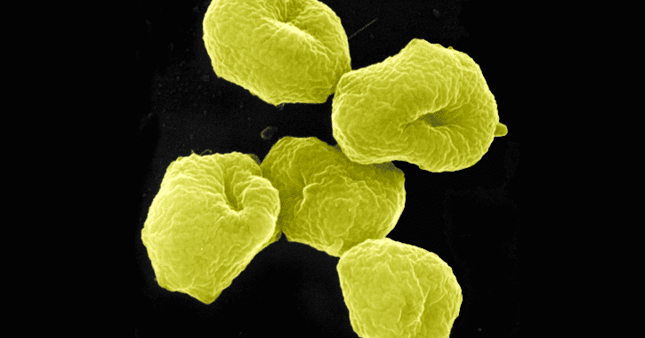 Microbiología: Dominio Archaea