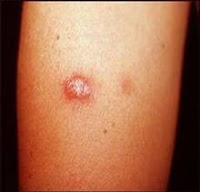 Semiologia qx.: Lesiones de la piel