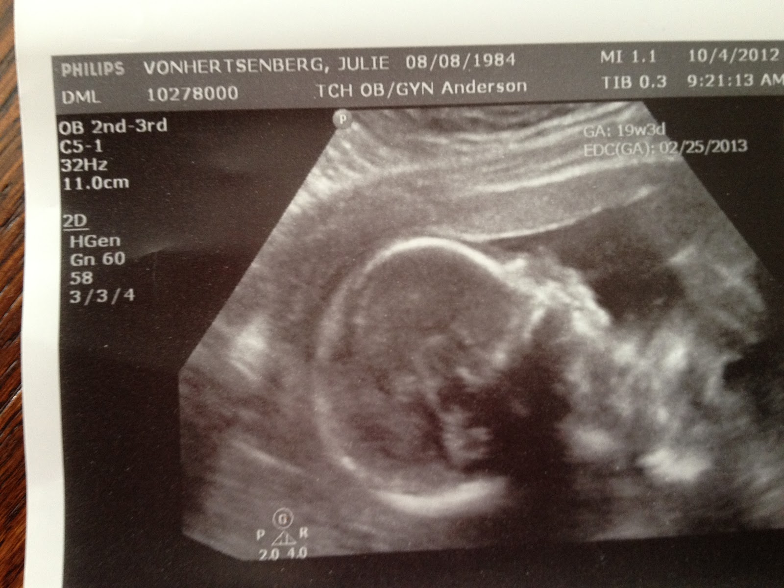 Our Family Journey: It's a Girl!! Ultrasound Pictures 19 weeks 3 days