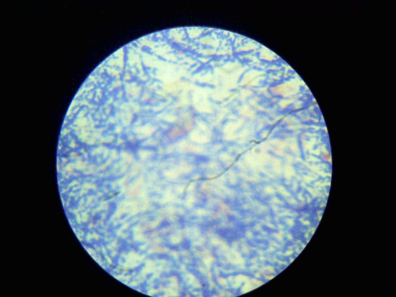 No Sweet Without Sweat: Pewarnaan Gram