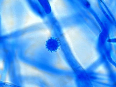 Fun With Microbiology (What's Buggin' You?): Sepedonium species