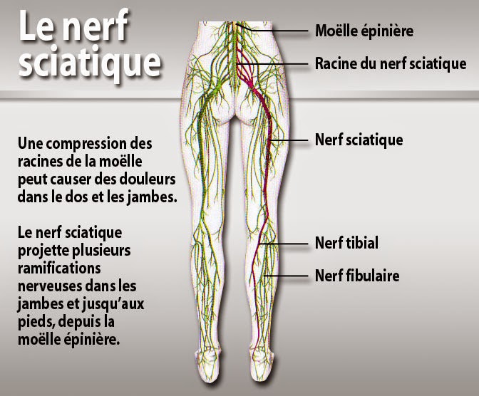 Valerie.D Reflexologie Plantaire: La sciatique
