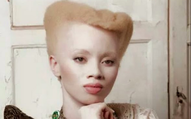 Sophie Mbeyu Blog: 12 Models With Albinism Who Are Taking The Fashion ...
