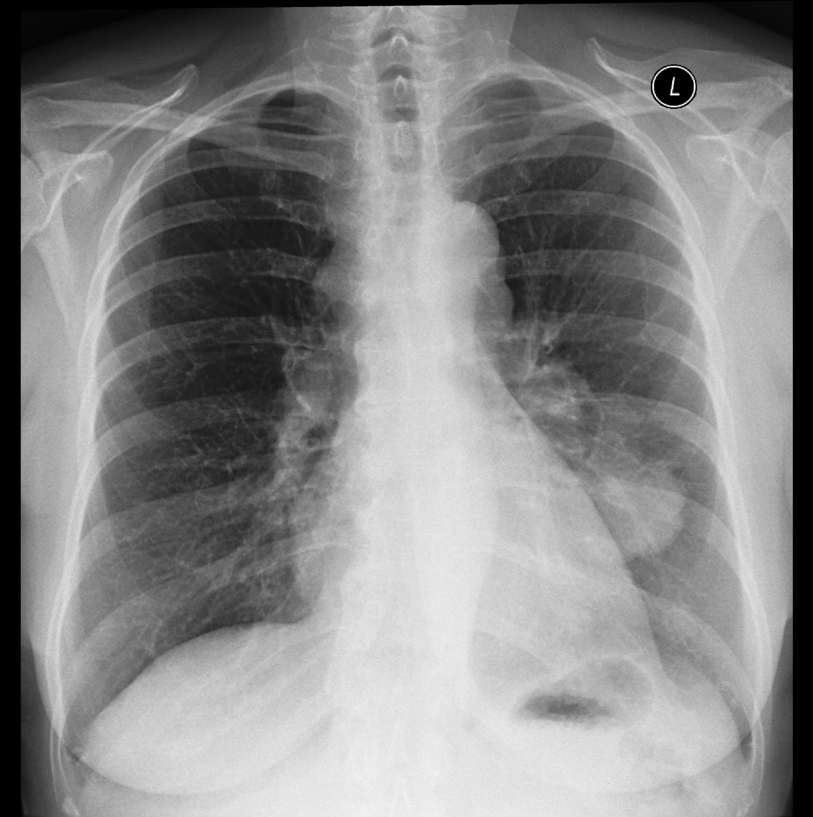 Michal Shark: Jak (ne) vyléčit RAKOVINU 4.díl - kam nás zavede strach