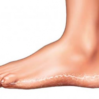 Un mundo mejor: LO QUE DEBERIAS DE SABER Y APRENDER : POR QUE ME DUELEN ...