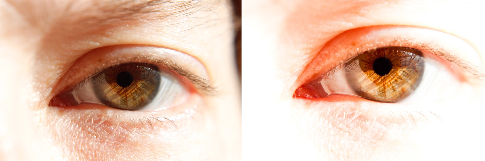 Make the Shot: Close-Up Eyeball | Boost Your Photography