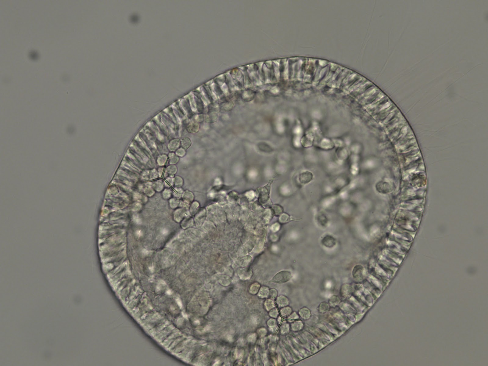 Invertebrate Embryology: Filopodia of mesenchymal cells in gastrulating ...