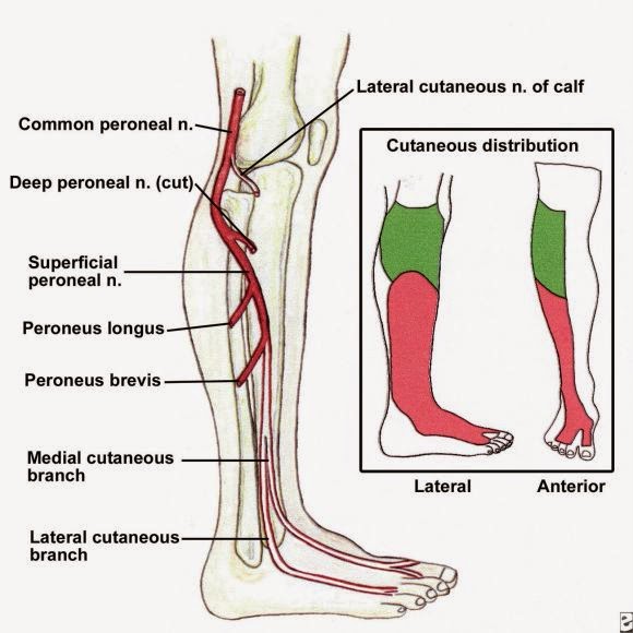 Sharan Boy : Common Peroneal Nerve injury ...