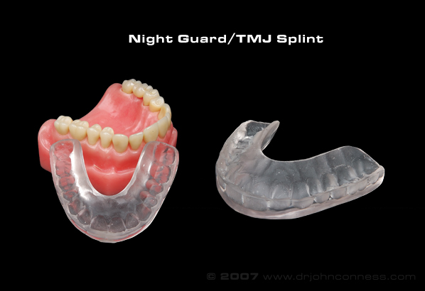 Wilson Dental: Night guards