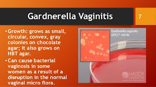gardnerella vaginalis - France news collections