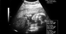 Poet in the Woods: Six months pregnant ...