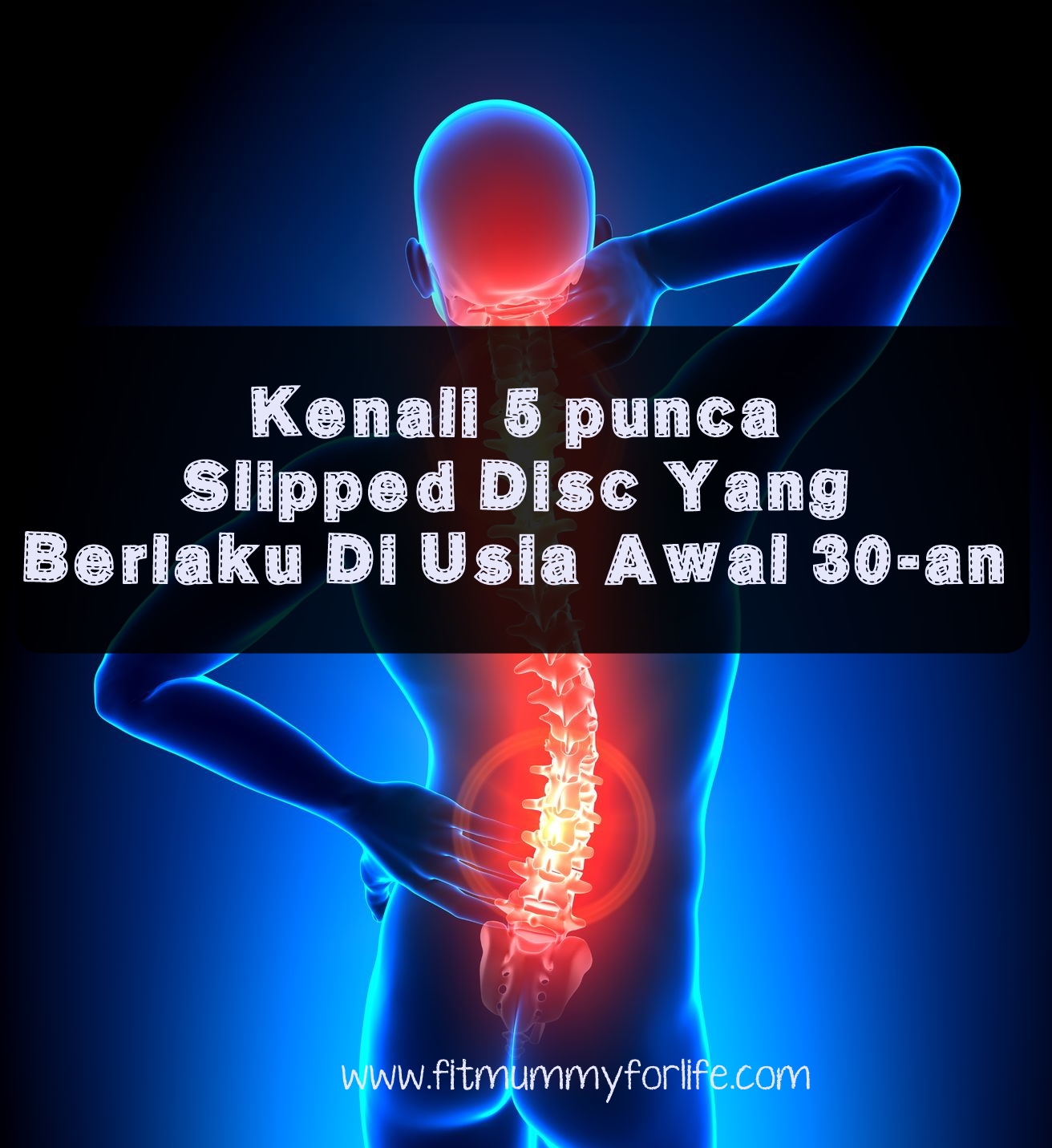 Kenali 5 punca Slipped Disc Yang Berlaku Di Usia Awal 30-an | Fit Mummy ...