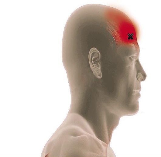 Physiotherapy: Myofascial Release