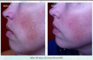 Keep Calm With Nerium: Nerium---Picture Time!