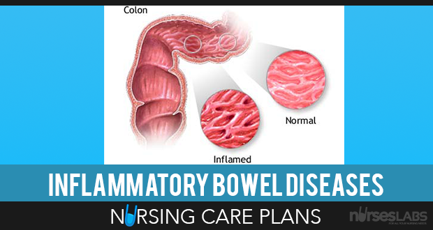 Inflammatory Bowel Disease (IBD) Nursing Care Plans | Nursing Care