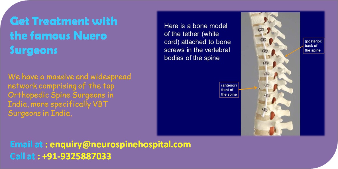 Vertebral Body Tethering Surgery, Cost And Top Orthopedic Spine ...