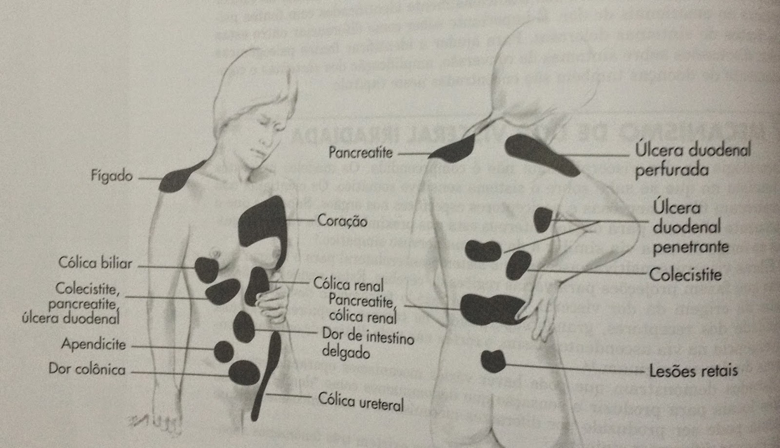 Osteopatia - O corpo como um todo...: Dor Visceral...